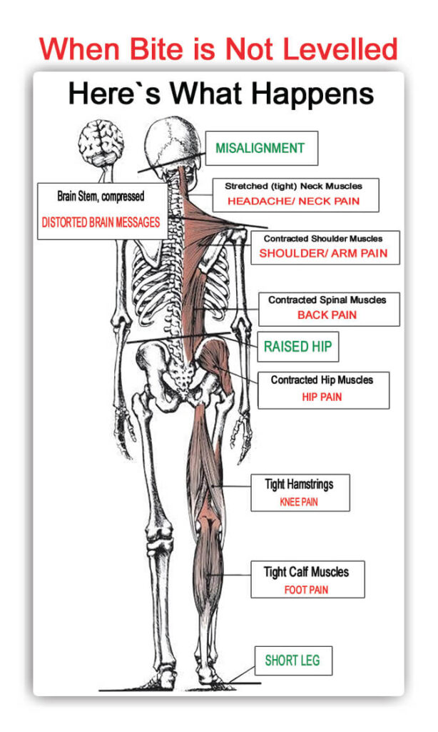 Free TMJ Consultation | Dental Clinic Seaford